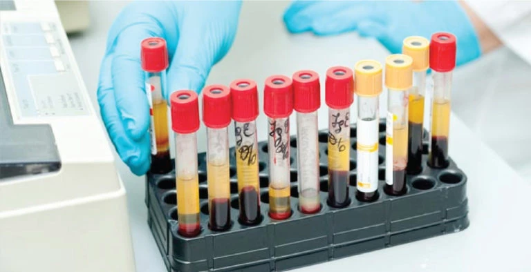 Relevance of Laboratory Management Software in Managing Samples